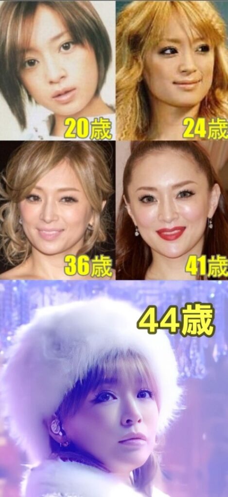 整形失敗がささやかれる芸能人&海外セレブTOP40 - レキシル[Rekisiru]