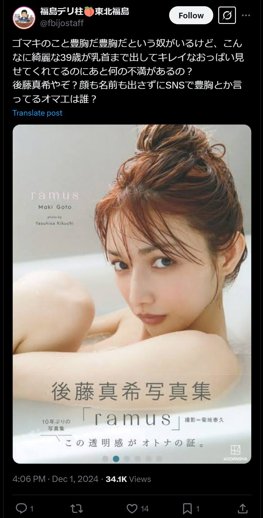 整形失敗がささやかれる芸能人&海外セレブTOP40 - 5ページ目 (22ページ中) - レキシル[Rekisiru]