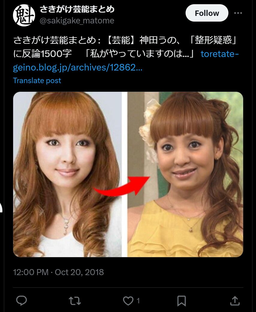 【悲報】劣化が激しいと話題の芸能人ランキング28選 - レキシル[Rekisiru]