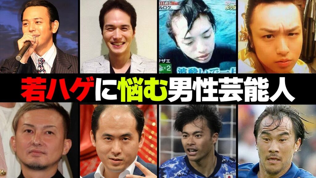 実はハゲている＆薄毛だと噂の芸能人衝撃度ランキングTOP25 - レキシル[Rekisiru]